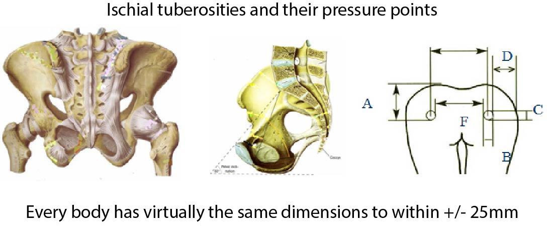 Ischial tuberosities – VSS Healthcare